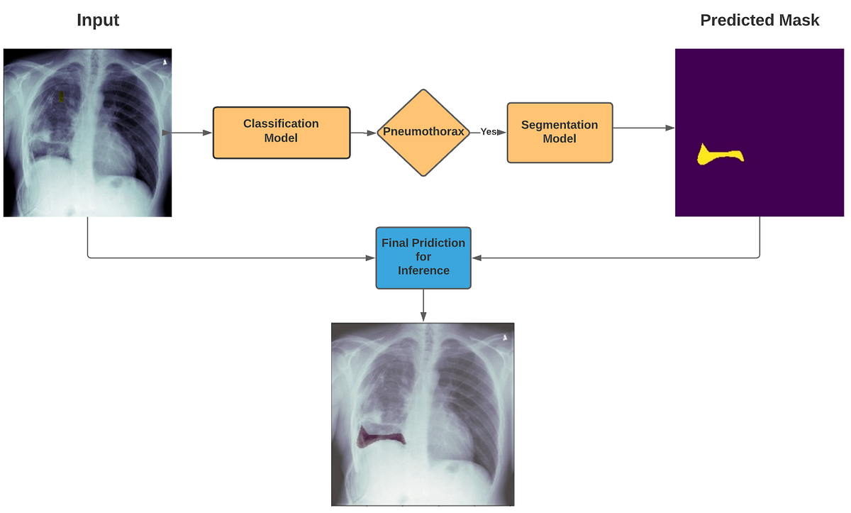 Semantic Segmentation for Pneumothorax Detection & Segmentation | by smit kumbhani | Becoming ...