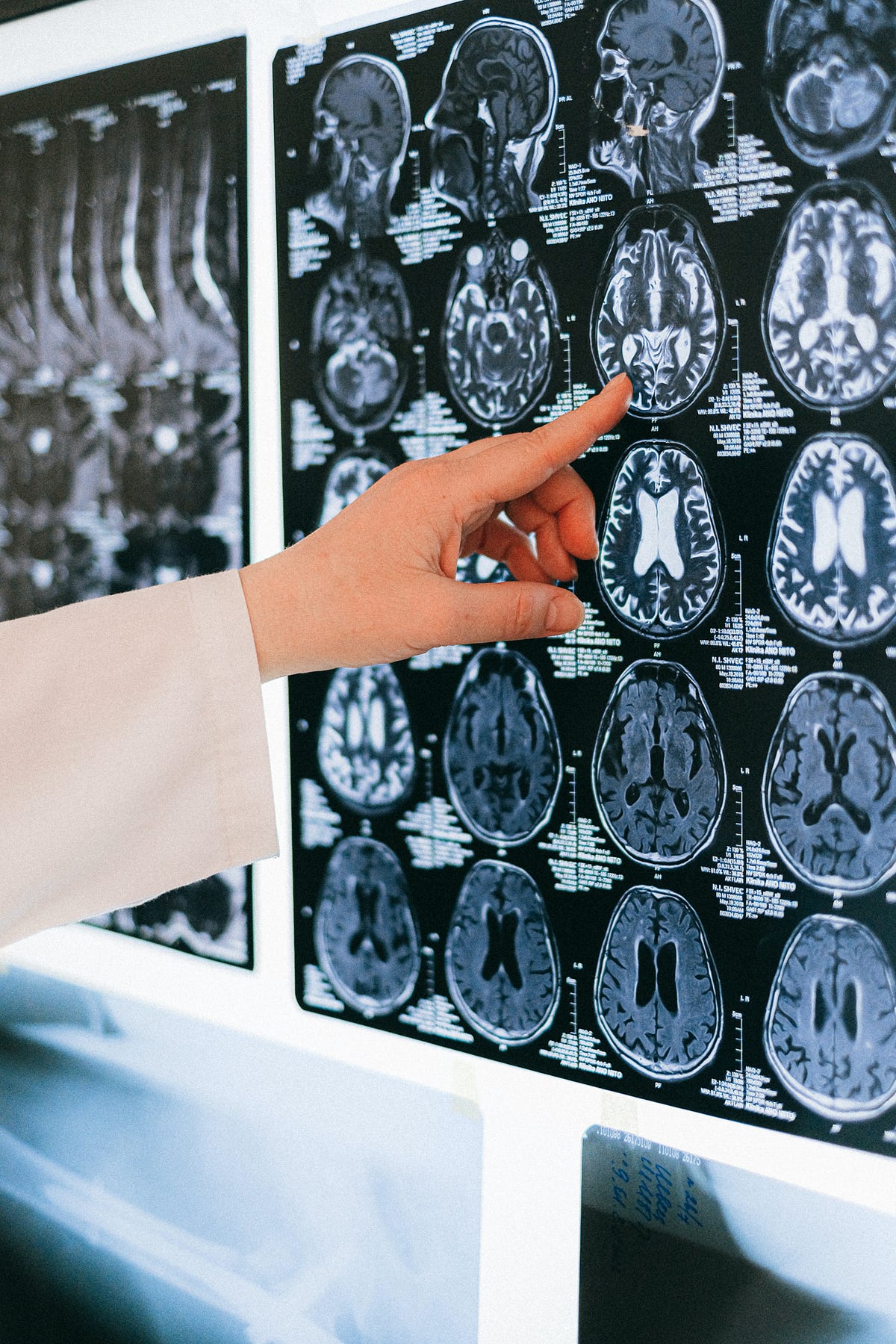 Human-Technology fusion and the Cross-Brain-Connect | by Mark Burnett ...