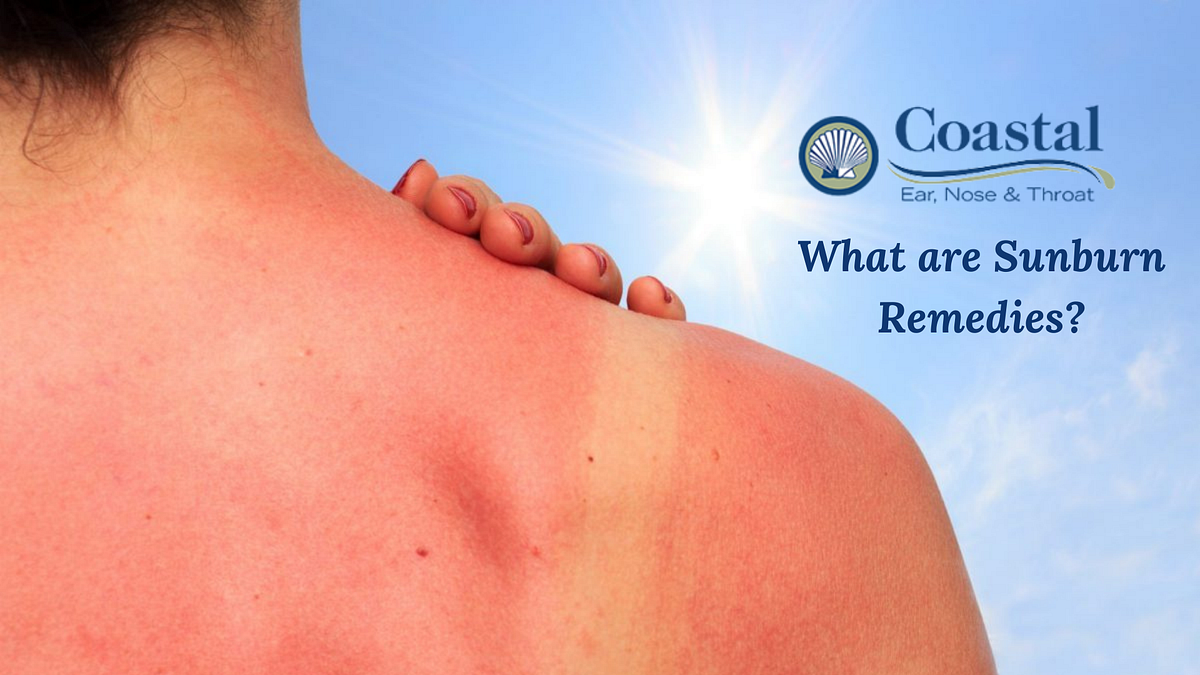 What are Sunburn Remedies?. For those of you planning on spending a ...