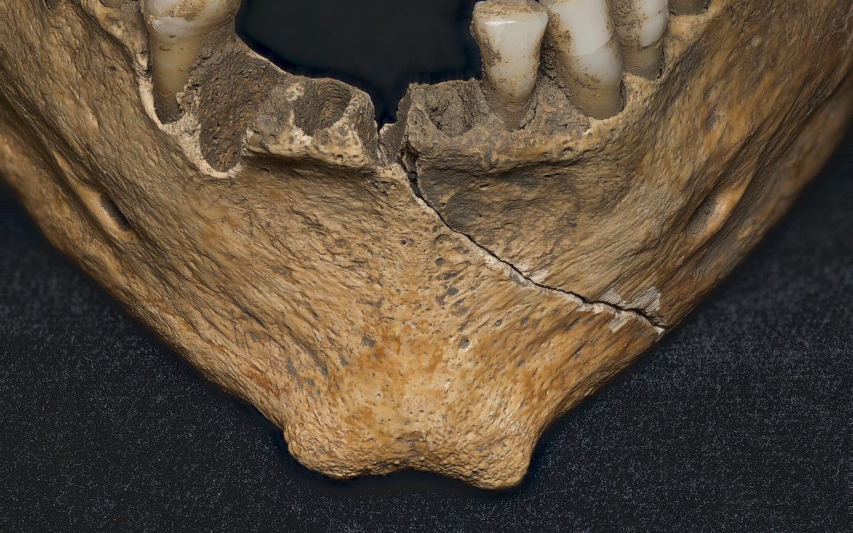 The Beauty of Bones. We are the sum of all our bones whether… | by ...