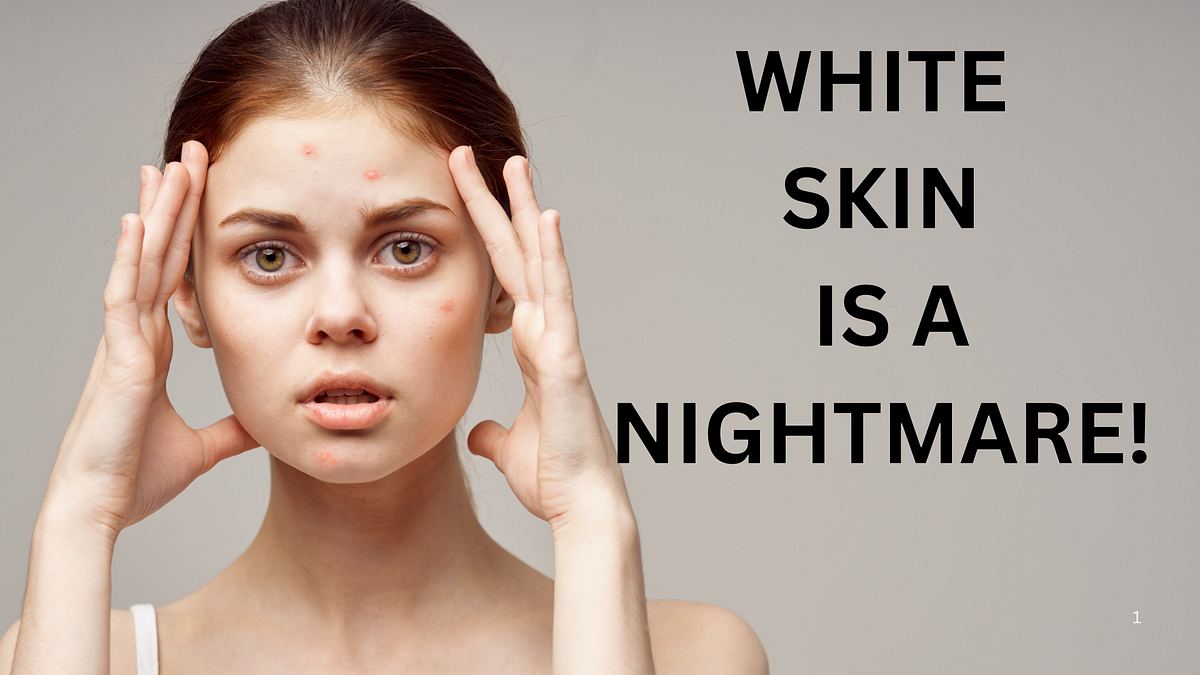 WHITE SKIN, A REALLY DIFFICULT SKIN, AND ALSO REALLY IMPURE! | by Joana ...