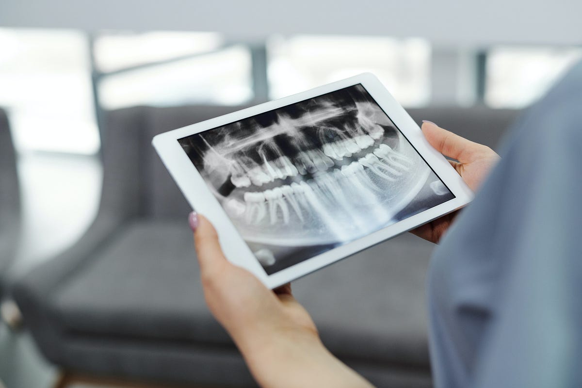 Revolutionizing Dental Care: How ChatGPT-4 Transforms Diagnosis and ... Revolutionizing Dental Care: How ChatGPT-4 Transforms Diagnosis and ...