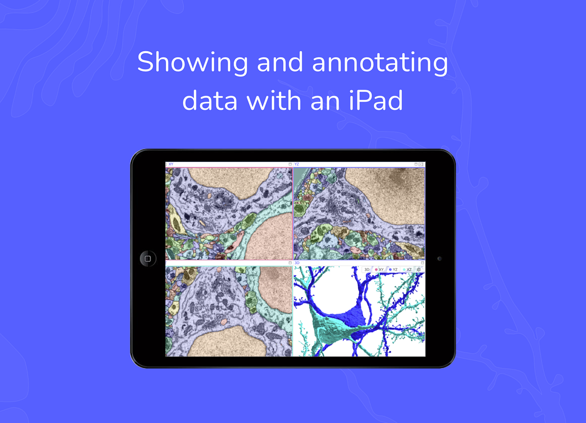 Showing and annotating data with an iPad | by Albane le Tournoulx de la ...