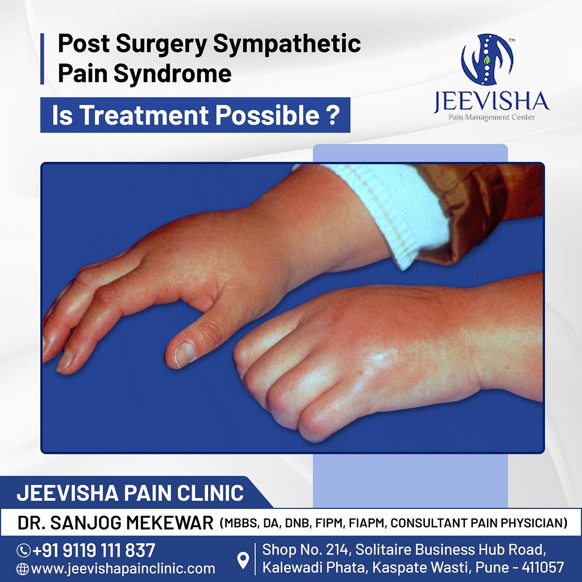 Post Surgery Sympathetic Pain Syndrome Is Treatment Possible ...