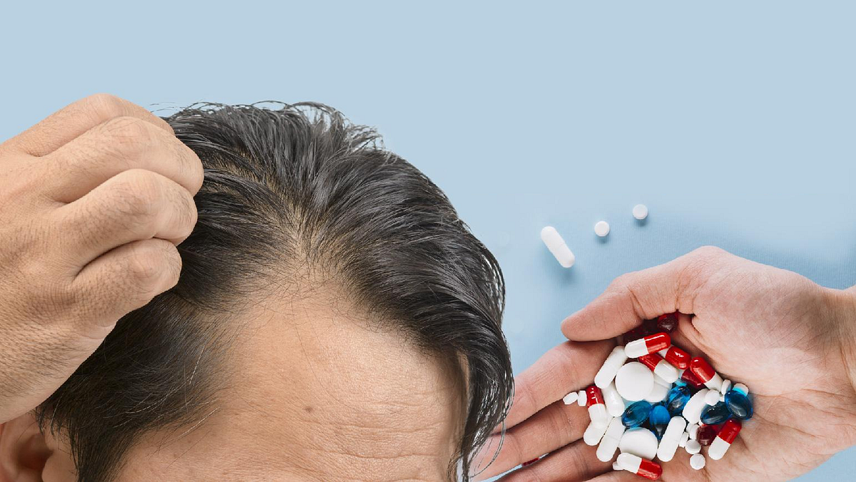 Finasteride: Your Guide to Benefits, Side Effects, and Uses | by ...