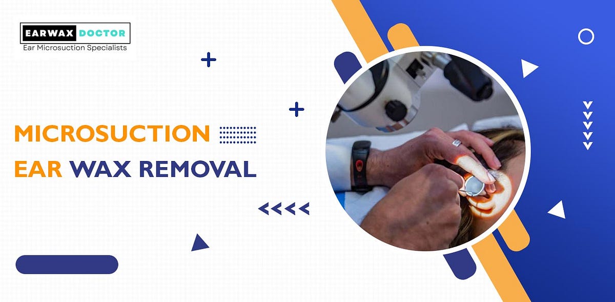 Exploring Microsuction Ear Wax Removal Techniques | by Earwax Doctor ...