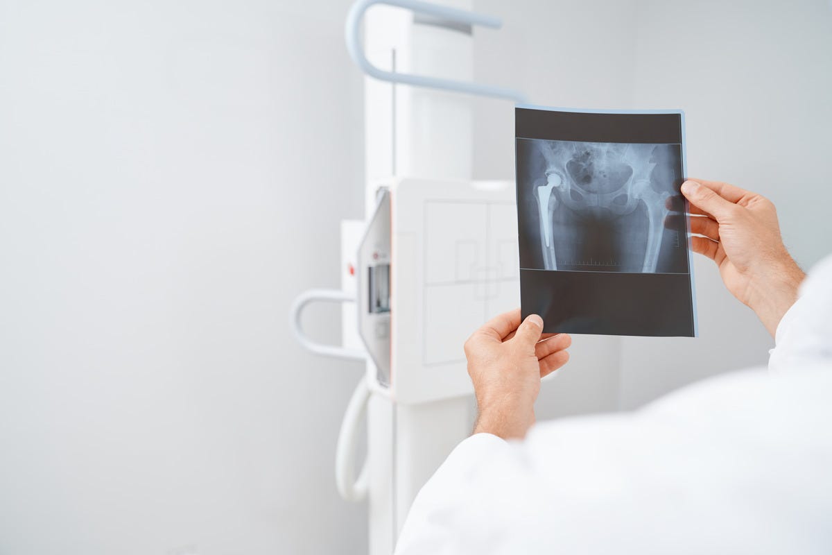 Best X-ray Clinic in Singapore - Acu Med - Medium
