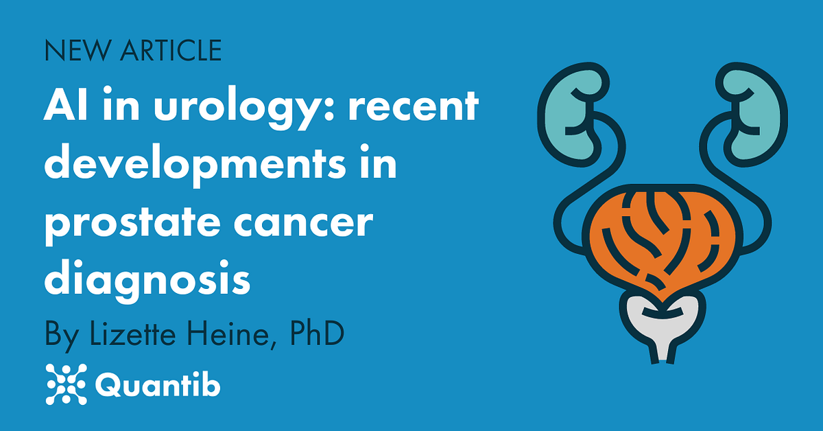 AI in urology: recent developments in prostate cancer diagnosis | by ...