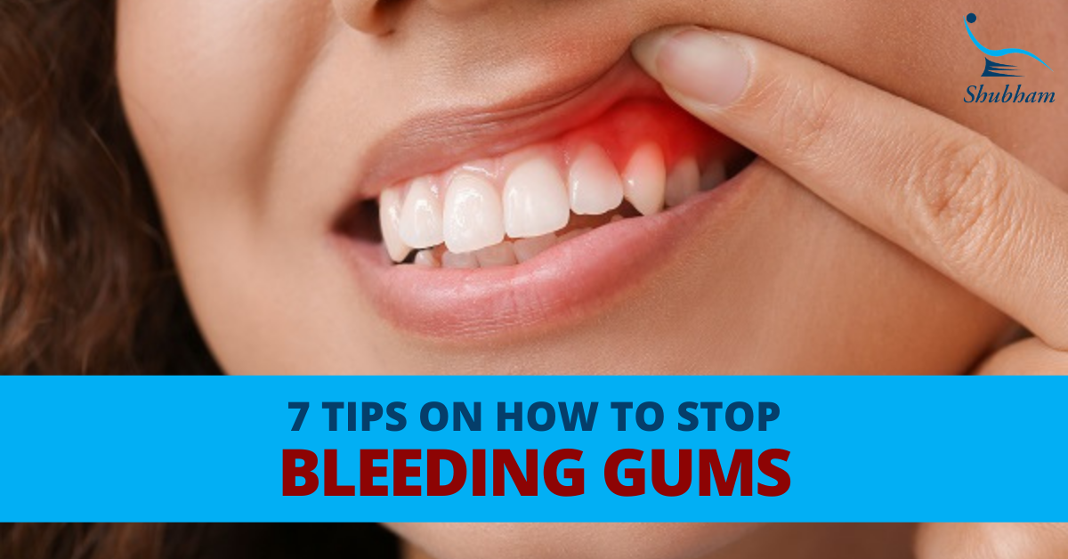 7 TIPS TO HOW TO STOP BLEEDING GUMS | by Dr. Rinku Mittal's Shubham ...