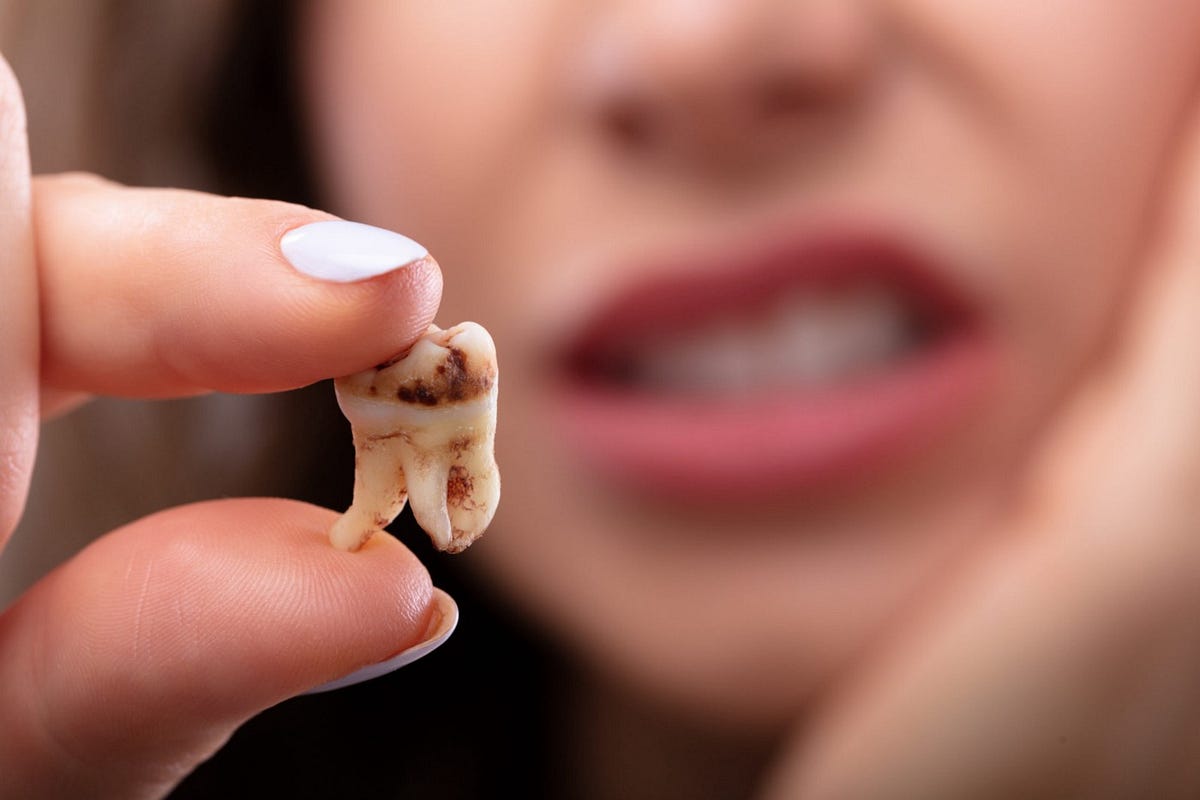 This Simple 20-Second Trick Turns Back Years Of Tooth Decay - Harshit ...