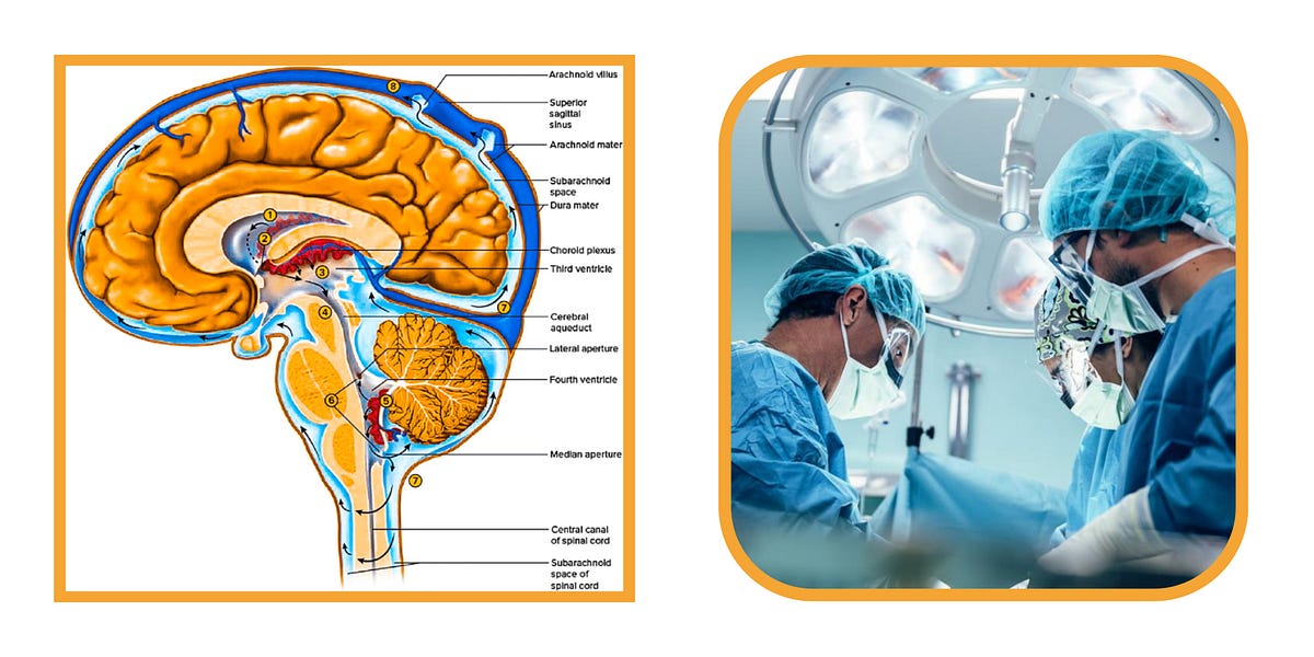Top Reasons Why People Need Neurosurgery Treatment | by Jagannathan ...