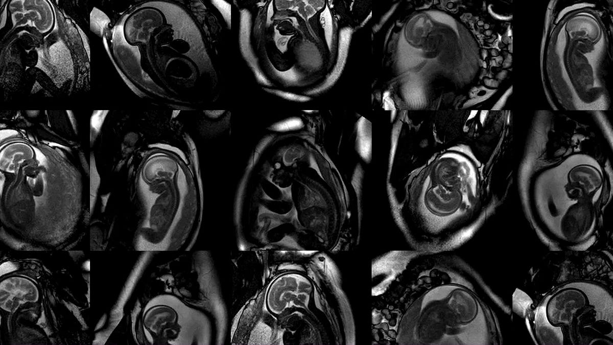 IN UTERO. Filmmaker Interview with Director… | by SIMA Studios | SIMA ...