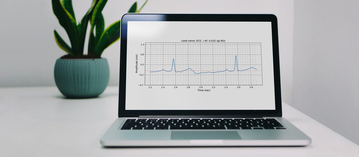 HRV Analysis and Atrial Fibrillation Detection using Machine Learning ...