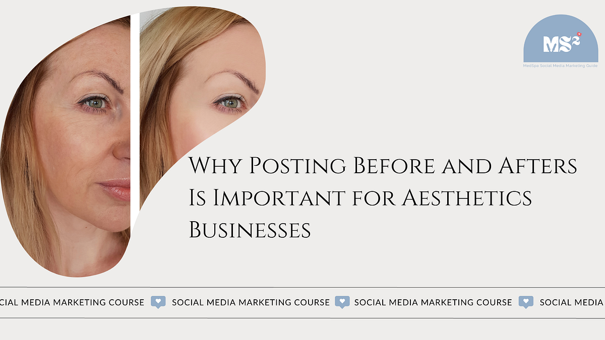 Why Posting Before and Afters Is Important for Aesthetics Businesses ...