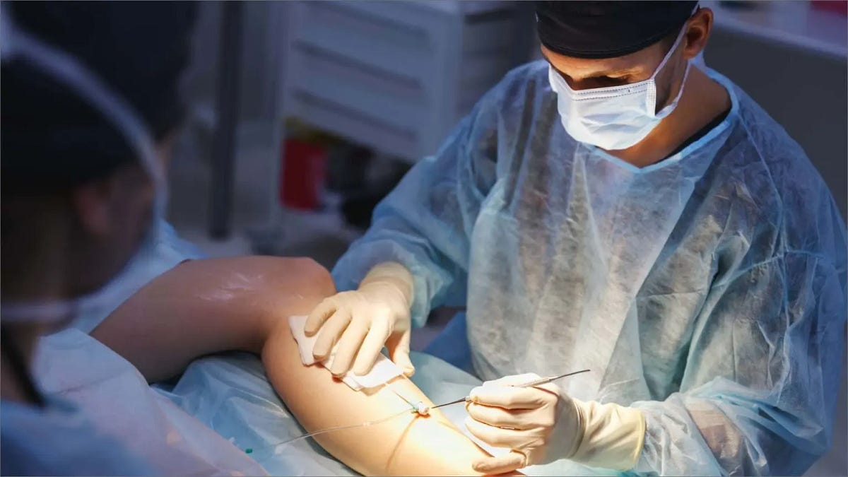 5 Common Vascular Procedures and Surgeries | by Milford Vascular ...