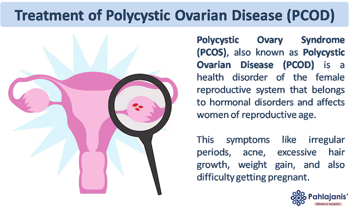 Polycystic Ovarian Disease (PCOD) Treatment Options in Raipur: What You Need to Know | by SEO ...