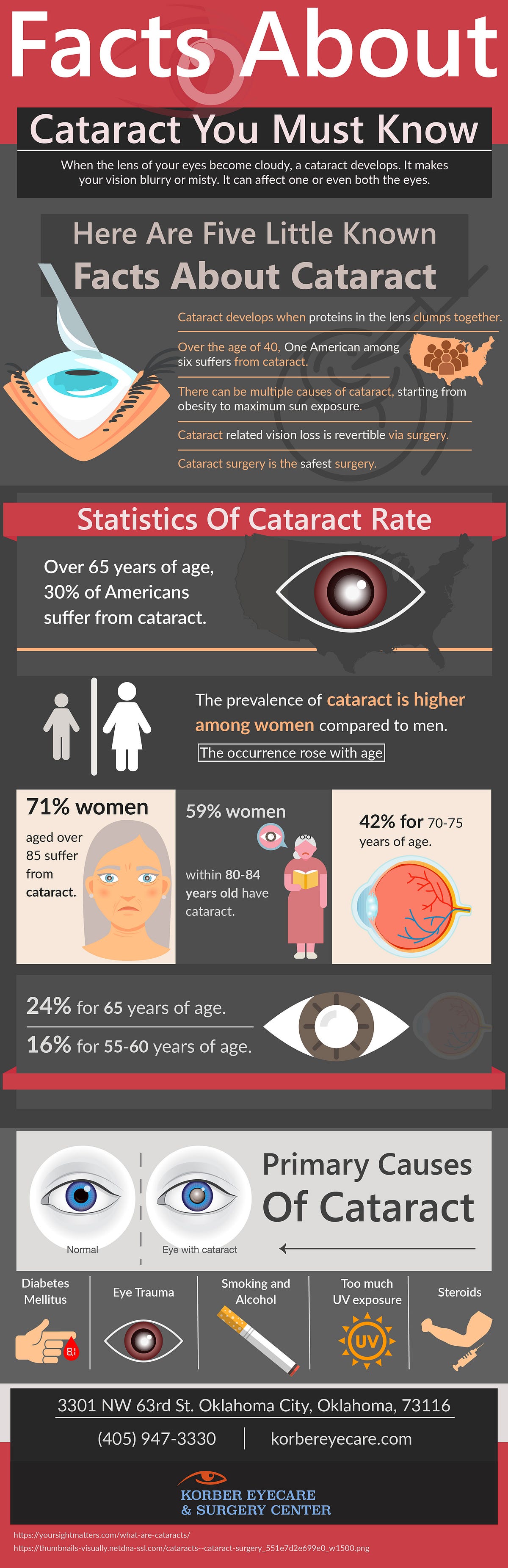 Facts About Cataract You Must know | by Korber Eyecare | Medium