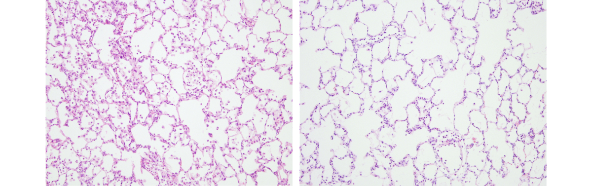 Cells, cell soup and treating lung inflammation | by Meredith Hanel ...