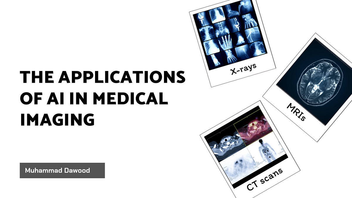 Applications of AI in Medical Imaging | Medium