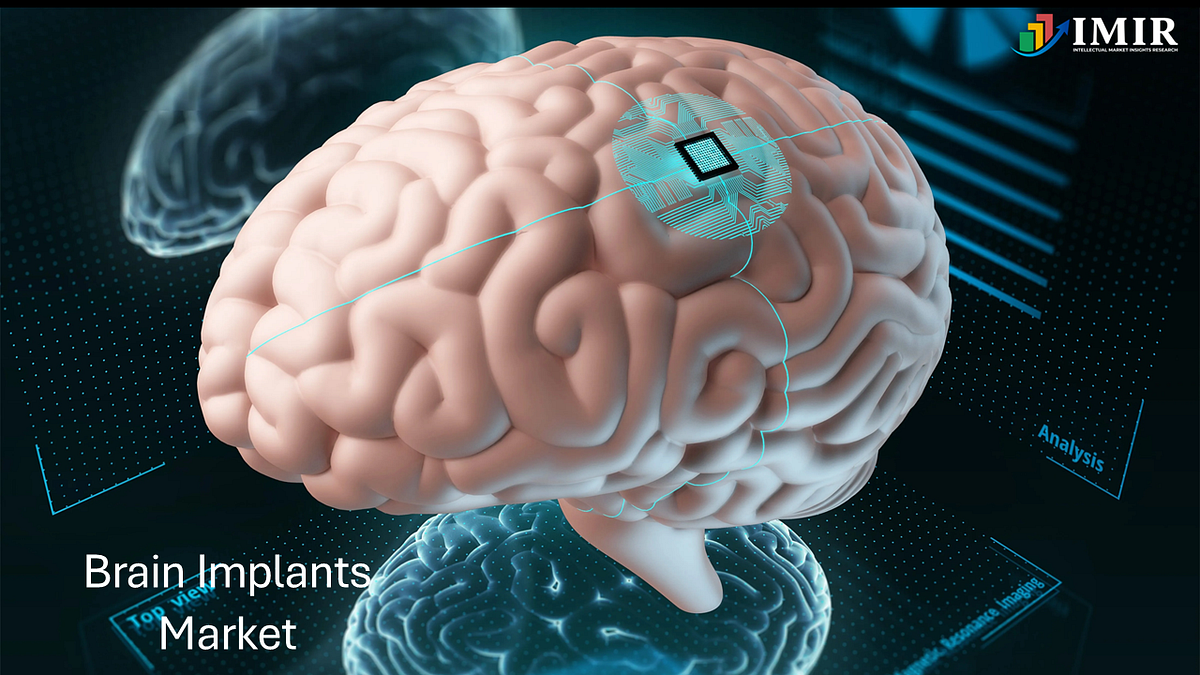 2024 Brain Implants Market: Leading Players Developments, Innovations ...