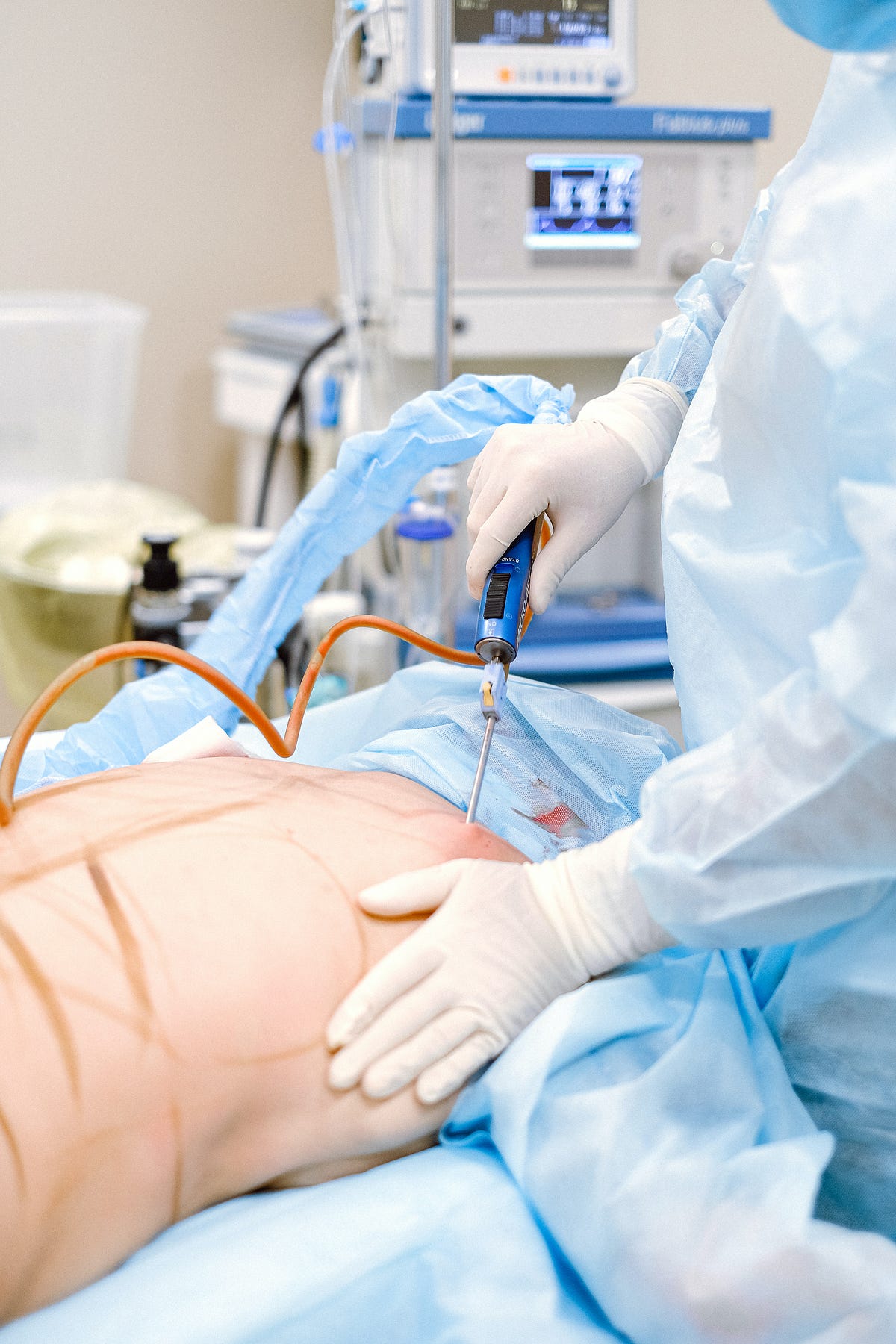 Hernia Surgery: Understanding the Procedure and What to Expect | by Dr ...