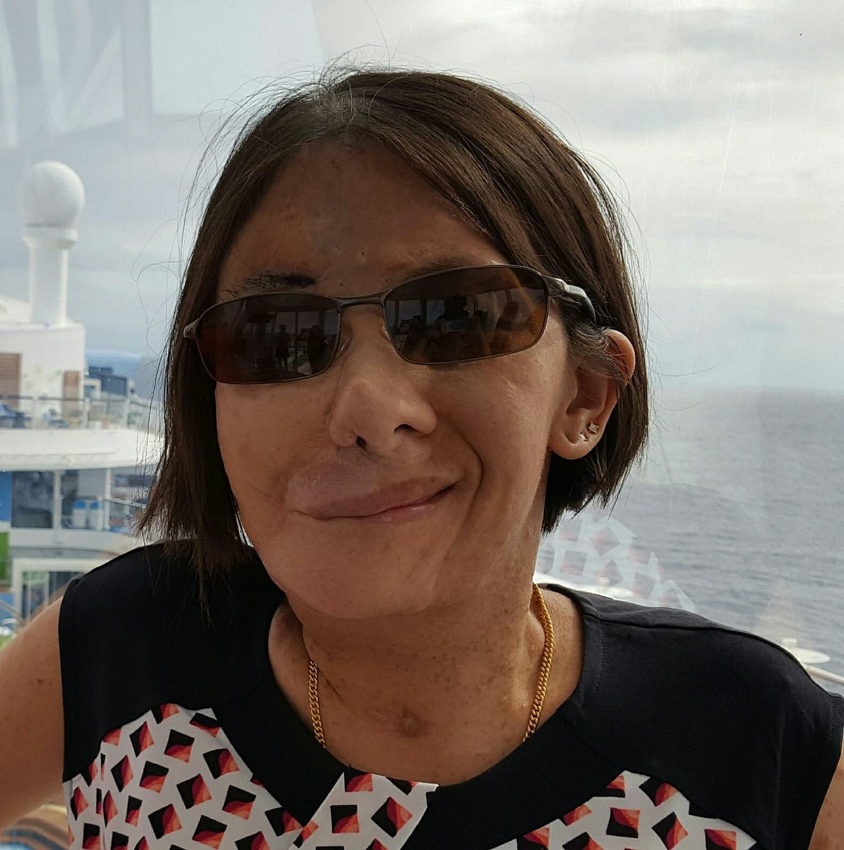 Interview #5: Becky Leung (Neurofibromatosis) | by Sarah Pruett | # ...