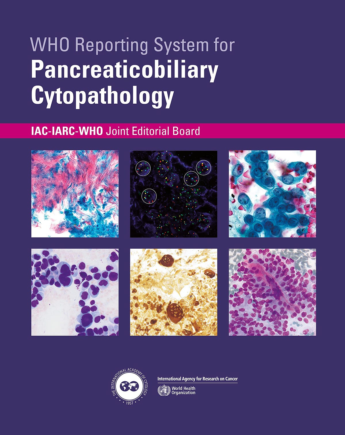 [EPUB[BEST]} WHO Reporting System for Pancreaticobiliary Cytopathology (WHO Reporting Systems ...