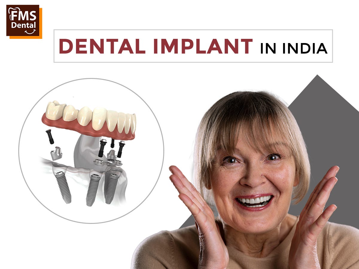 Why India Has Become a Favourite Destination for Dental Implants? | by ...