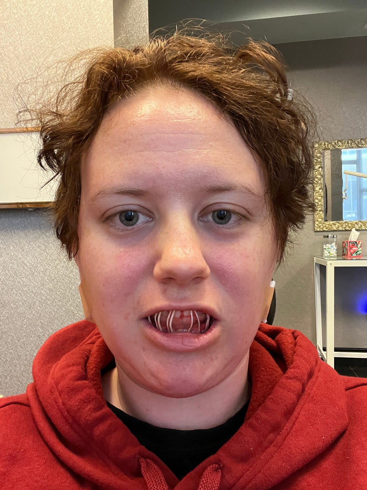 Day 1 Double Jaw Surgery Post-Op | by Danielle Morgan | Medium