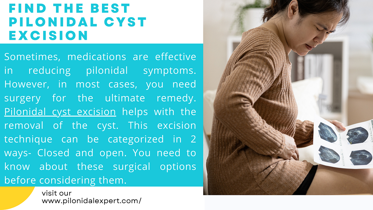 Find the best Pilonidal Cyst excision - DaniellaLloyd - Medium