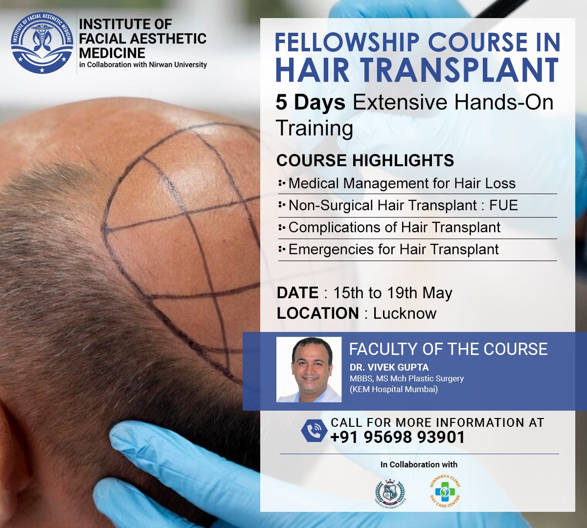 Mastering Hair Restoration: A Deep Dive into the Fellowship in Hair ...
