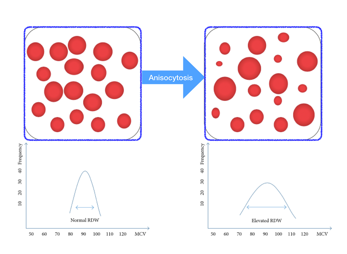 RDW高代表什麼？Red cell distribution width (RDW)之臨床應用 - Dr. LYK - Medium