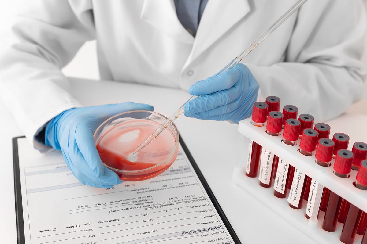 Reliable Blood Test Centers in Chandigarh: Why Sanjivini Diagnostics Is ...