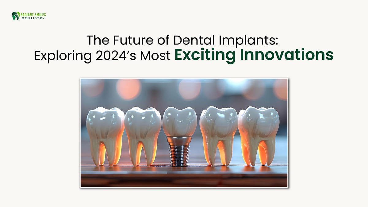 The Future of Dental Implants: Exploring 2024’s Most Exciting ...