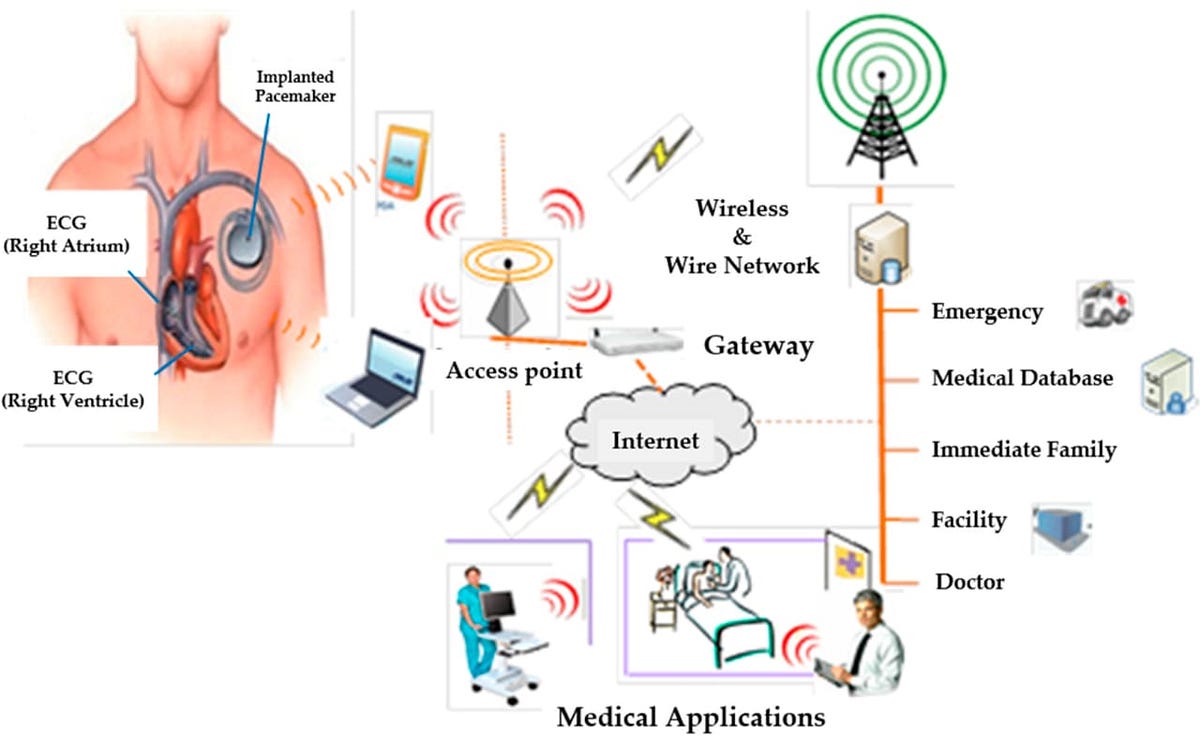 Design of Sensors for Monitoring Vital Signs like Heart Rate and Blood ...