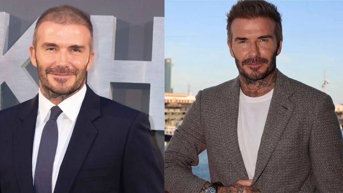 David Beckham Hair Transplant: The Truth Behind His Iconic Look | by ...