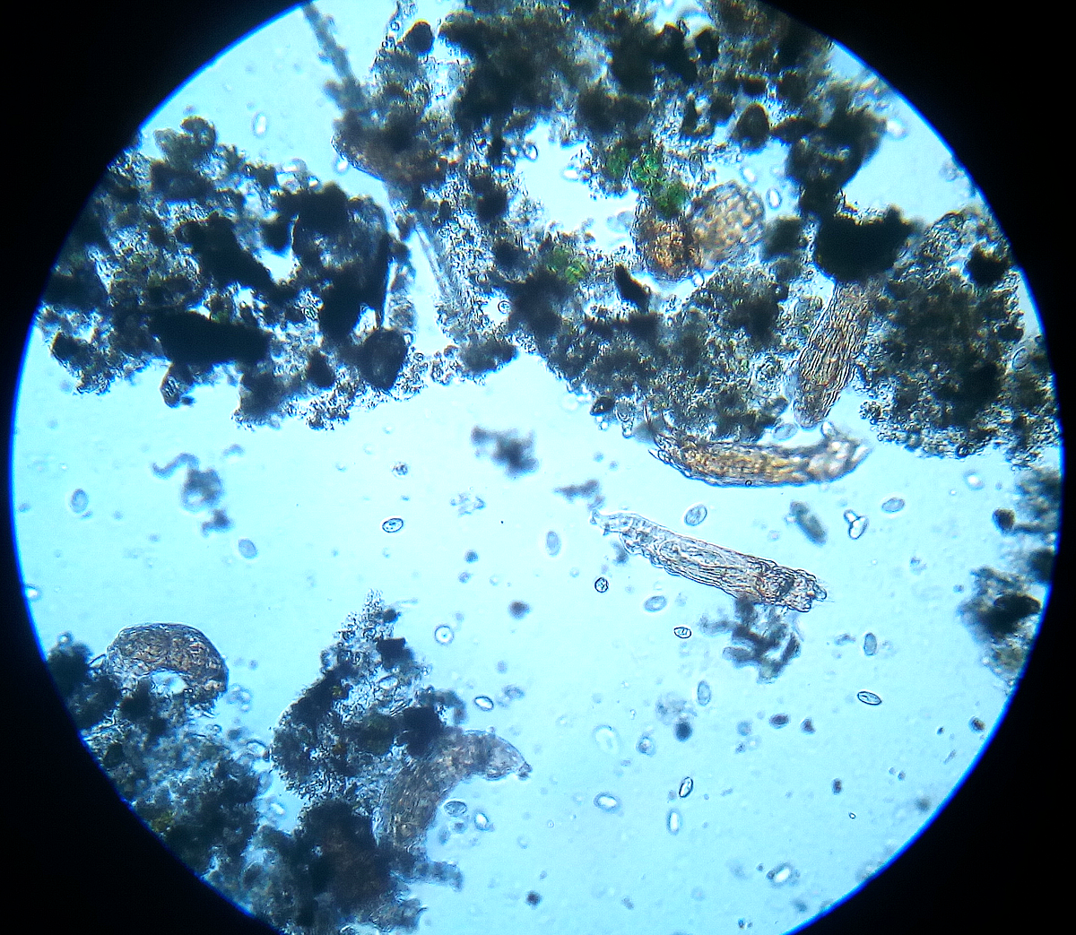 First Encounter With Fascinating Microscopic Animals! | by VigyanShaala ...