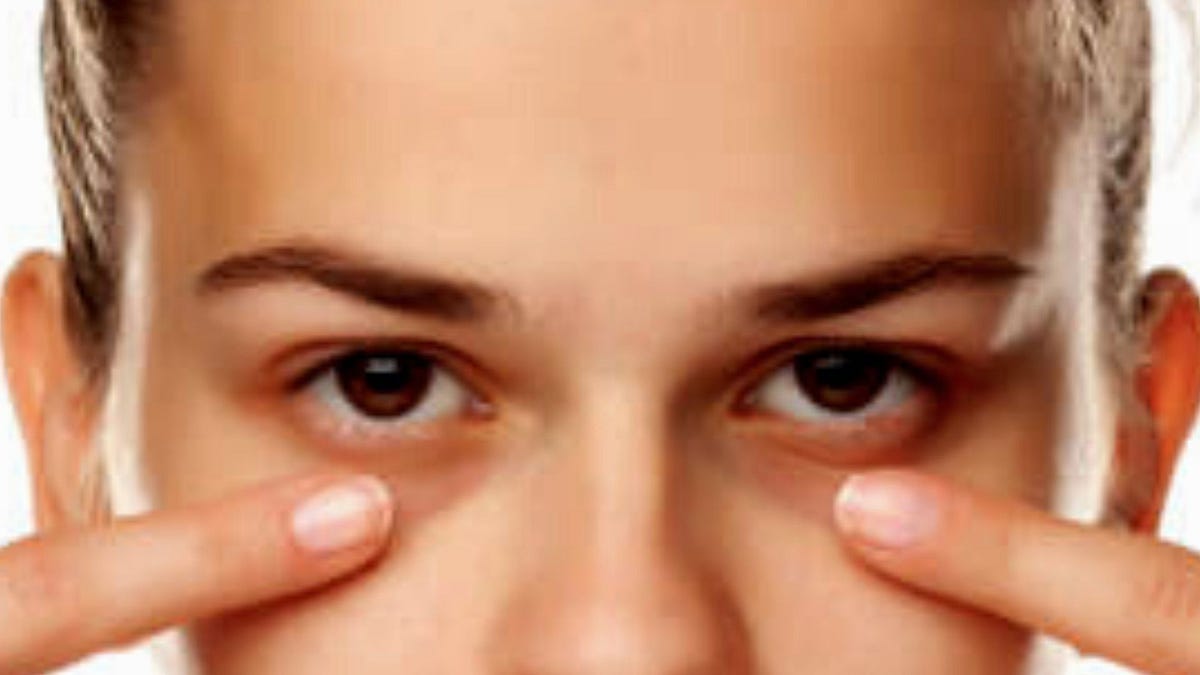 The Best Treatment for Dark Circles Naturally. - KnowledgeOne.online - Medium