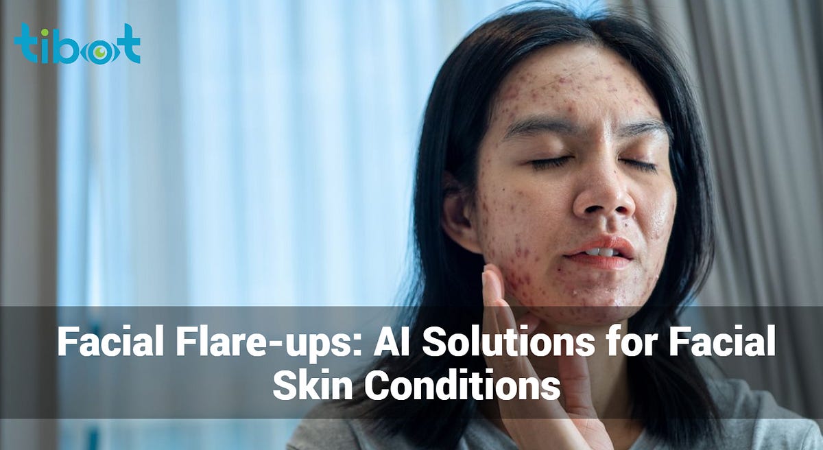 Facial Flare-ups Resolved: AI Empowered Solutions for Facial Skin ...