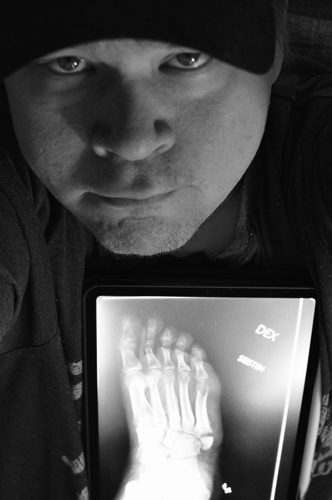 The First Checkup of my Charcot Foot | by Ilkka Koski | Medium