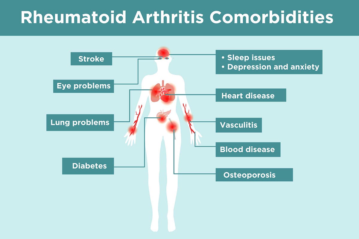 Biological Breakthroughs: Revolutionizing Rheumatoid Arthritis ...