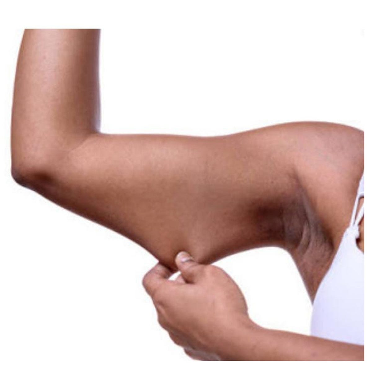 SAGGING SKIN AND DIETS. If you are worried about your loose… | by NFDC ...