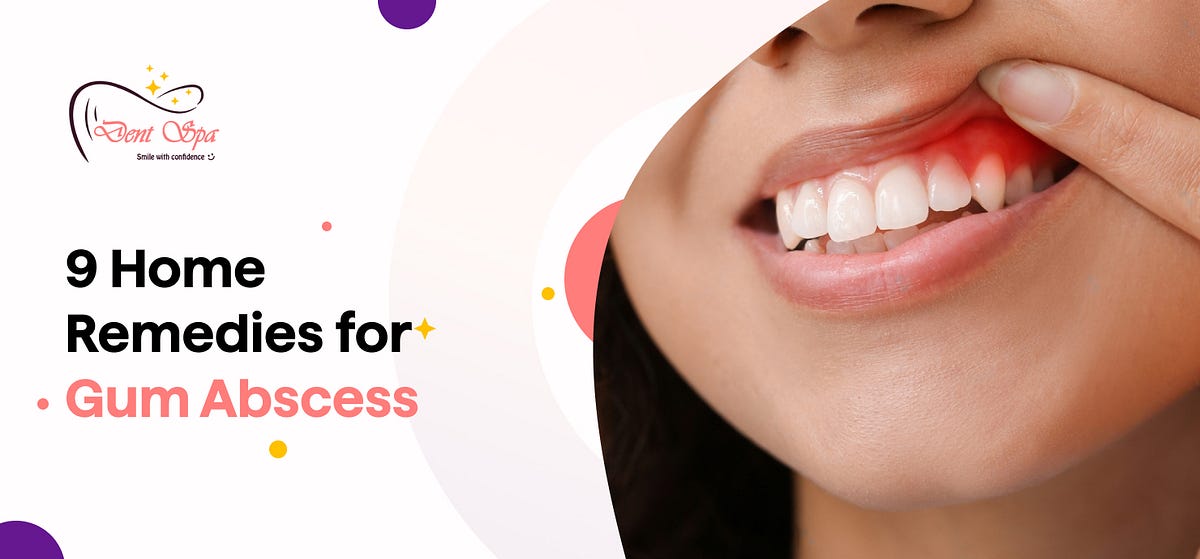 Home Remedies For Gum Abscess Do You Find Your Gum Abscess Bothersome By Dentspa May 2024