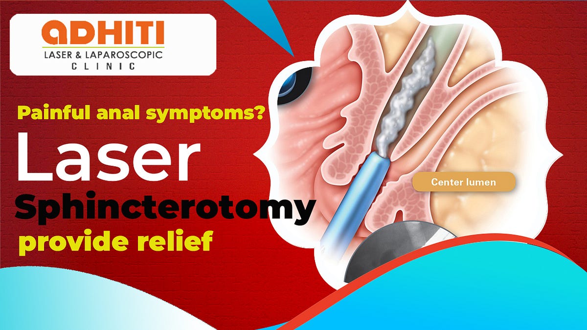 Best Laser Sphincterotomy in L.B Nagar | by adhitilaserand ...