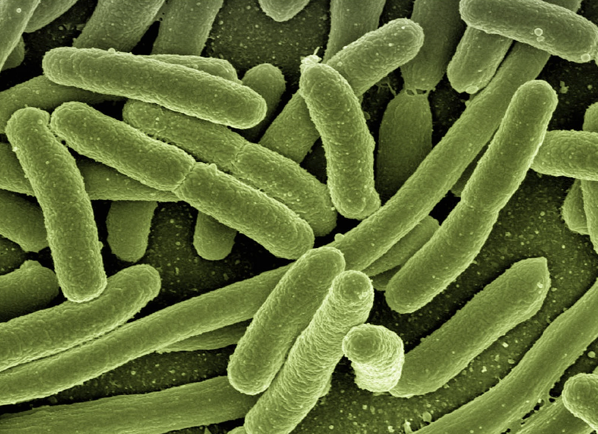 A New Space Bacterium? What Scientists Found in Space | by Harvard ...