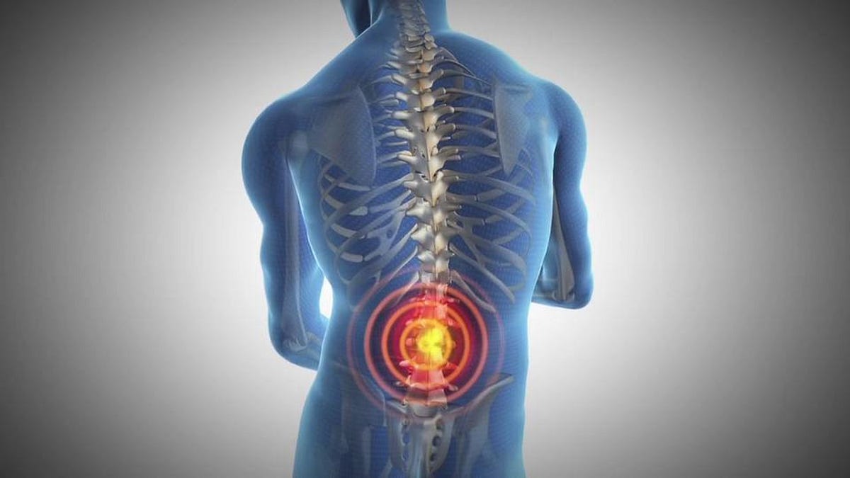 What Causes Low Back Pain?. Low back pain is a very common issue… | by ...