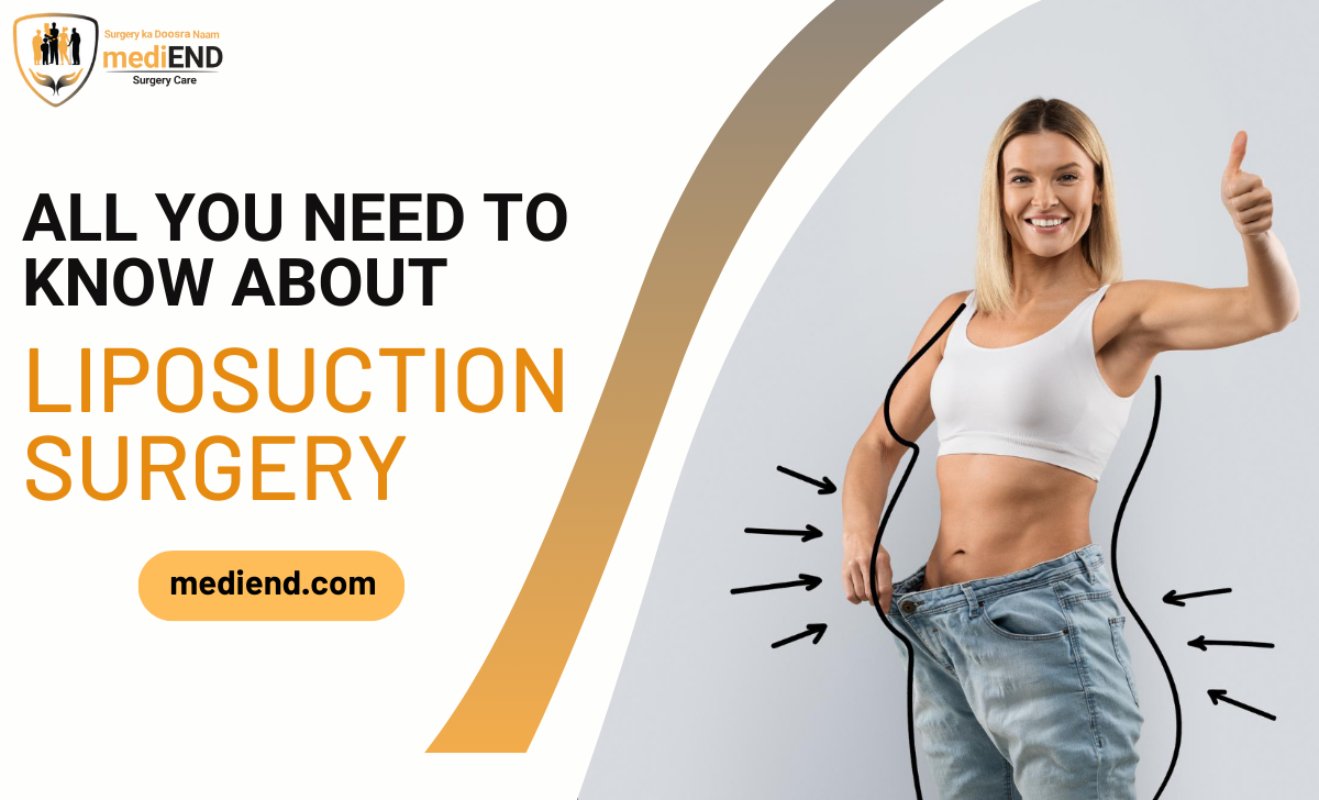 All You Need to Know about Liposuction Surgery and its Benefits | by Mediend Digital | Aug, 2024 ...