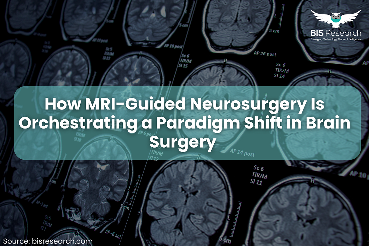 How MRI-Guided Neurosurgery Is Orchestrating a Paradigm Shift in Brain ...