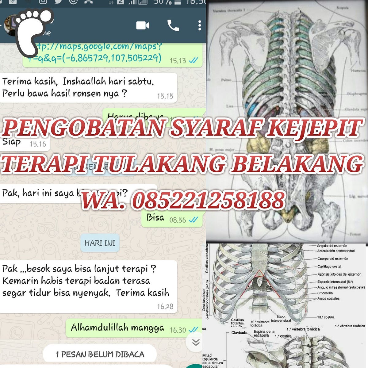 bahaya syaraf kejepit dan cara menanganinya. | by Pengobatan Syaraf ...