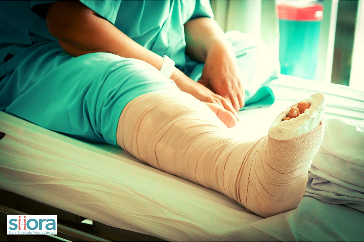 Resetting a Broken Bone — What Do You Need to Know About? - Siiora ...